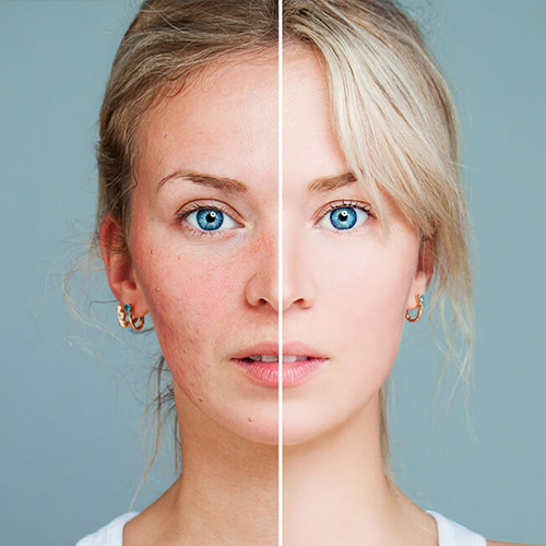 Mini-Routine for Sensitive & Delicate Skin | www.theeuropeantouch.com